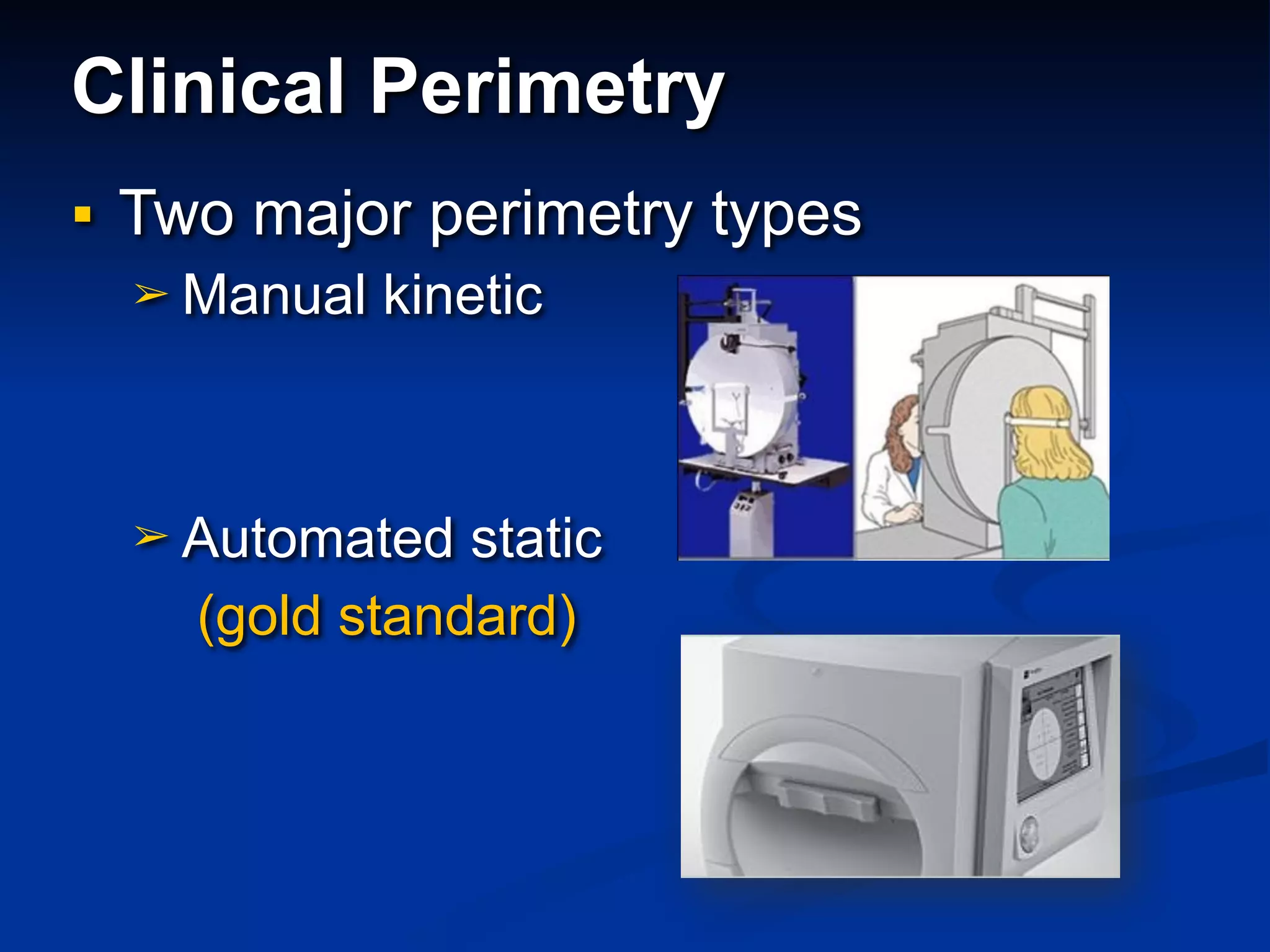 Visual Field in Glaucoma | PDF