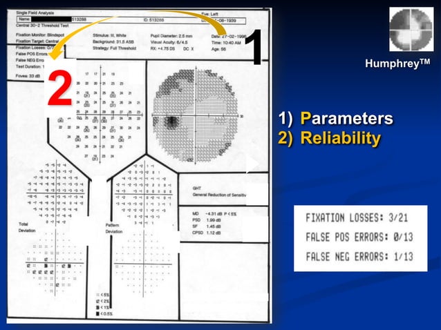 Visual Field in Glaucoma | PDF | Eye and Vision Conditions | Diseases ...