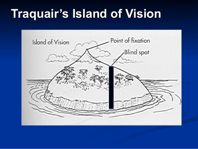 Visual Field in Glaucoma
