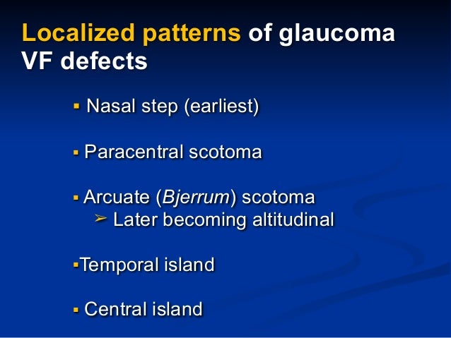 Visual Field in Glaucoma