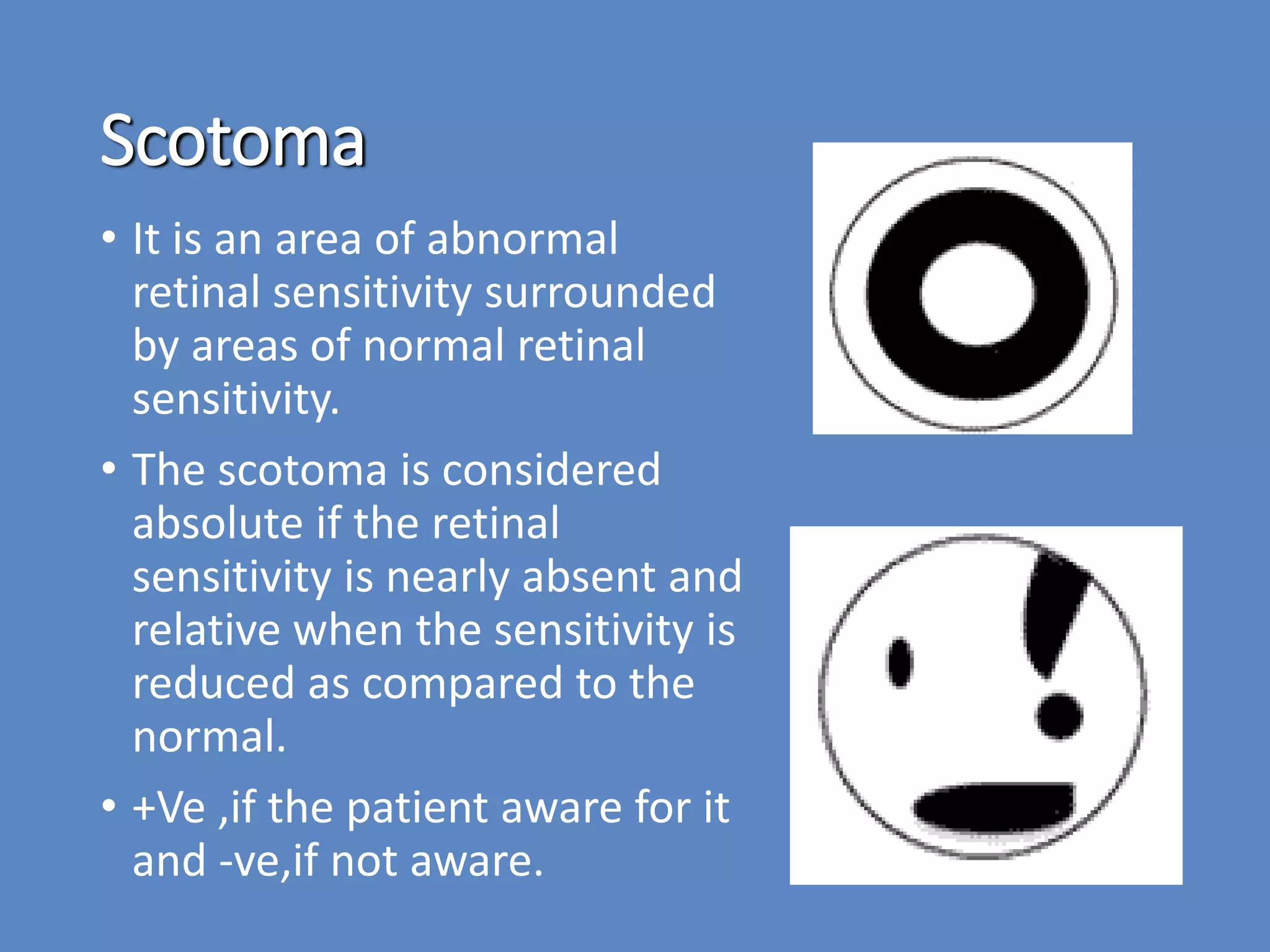VF in glaucoma.pptx