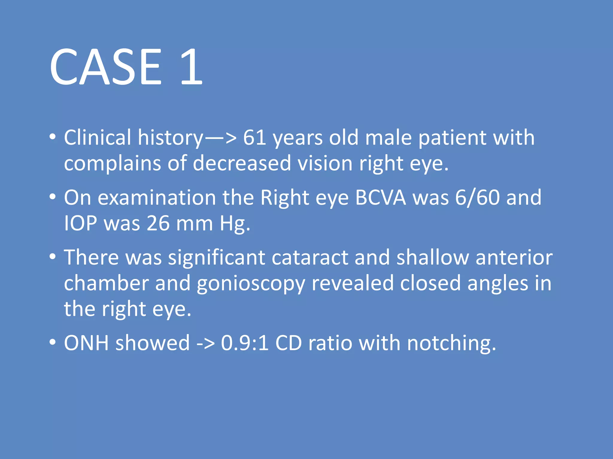 VF in glaucoma.pptx