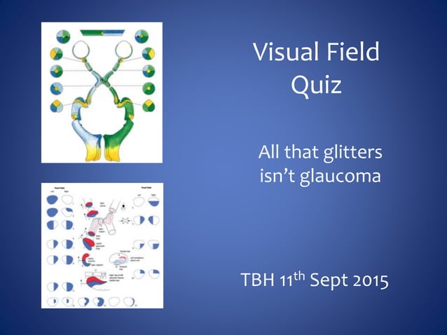 Visual Field Quiz | PPTX | Eye and Vision Conditions | Diseases and ...