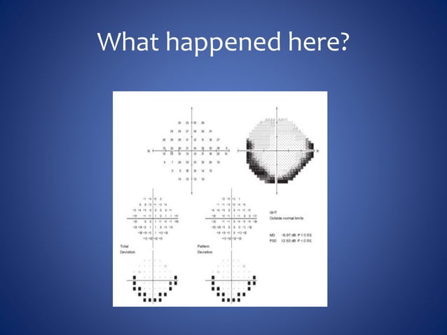 Visual Field Quiz | PPTX | Eye and Vision Conditions | Diseases and ...