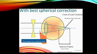 Technique of Jackson cross cylinder | PPTX