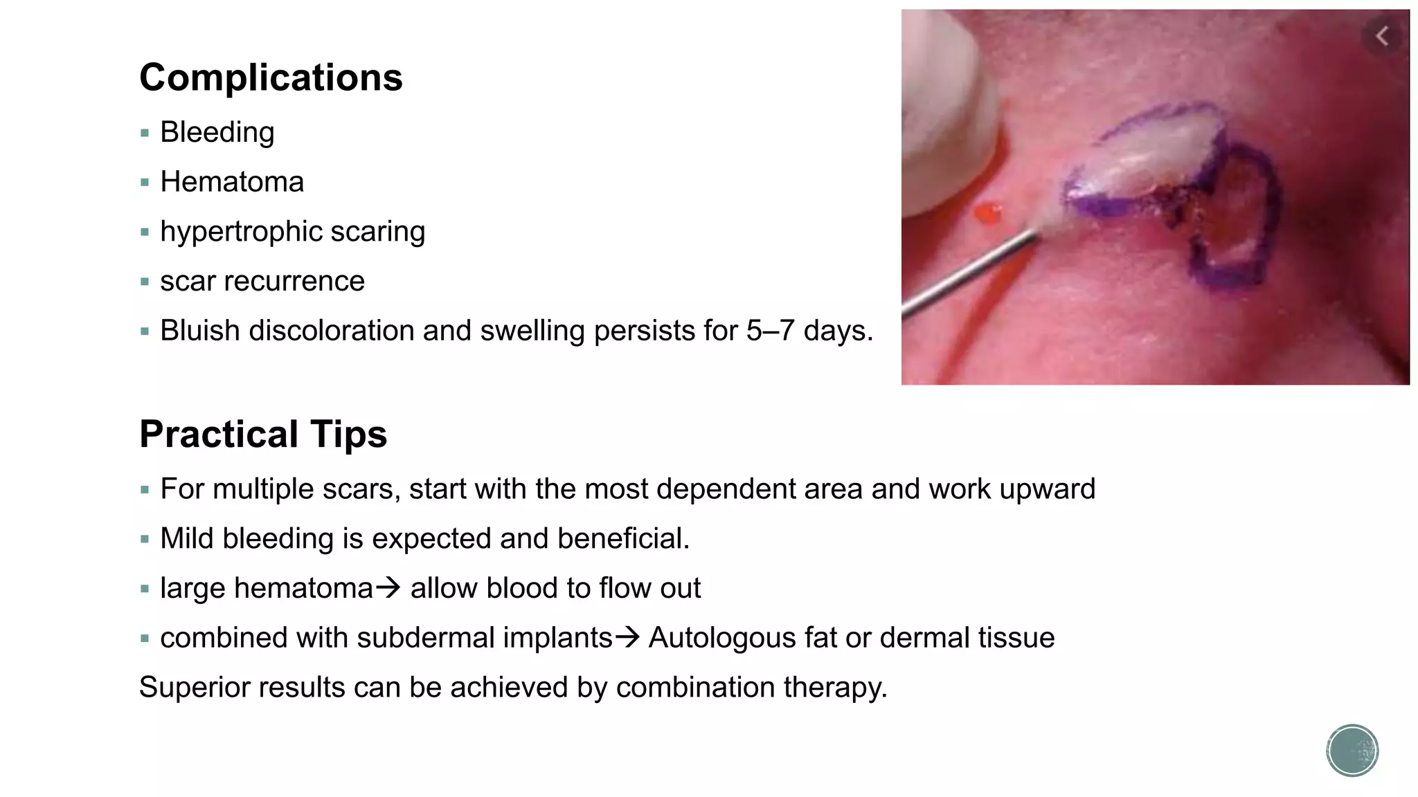 Acne scar management | PPTX