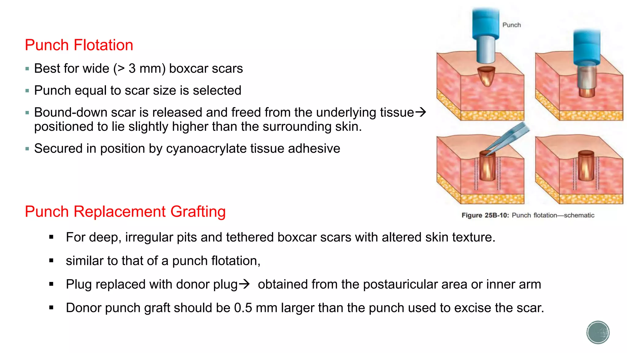 Acne scar management | PPTX