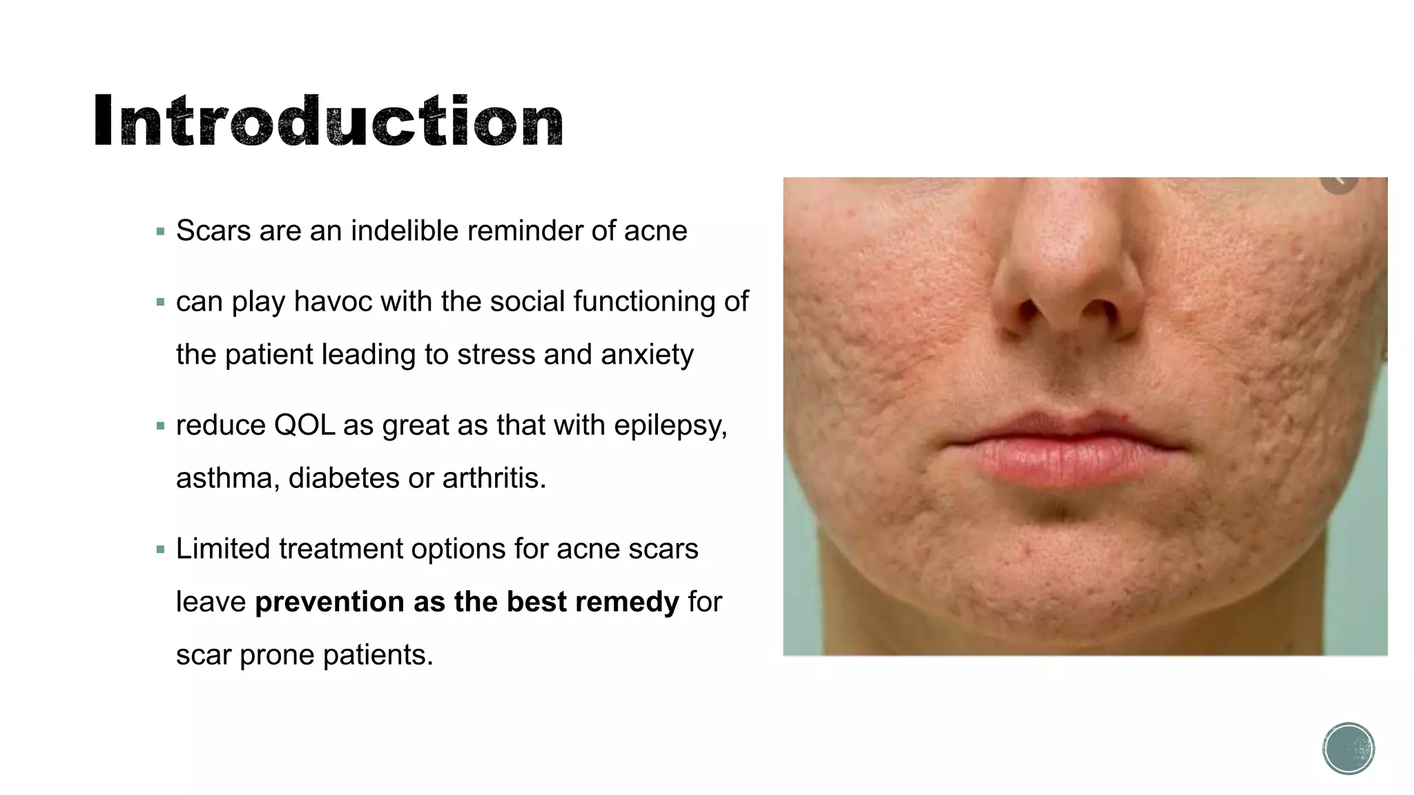 Acne scar management | PPTX