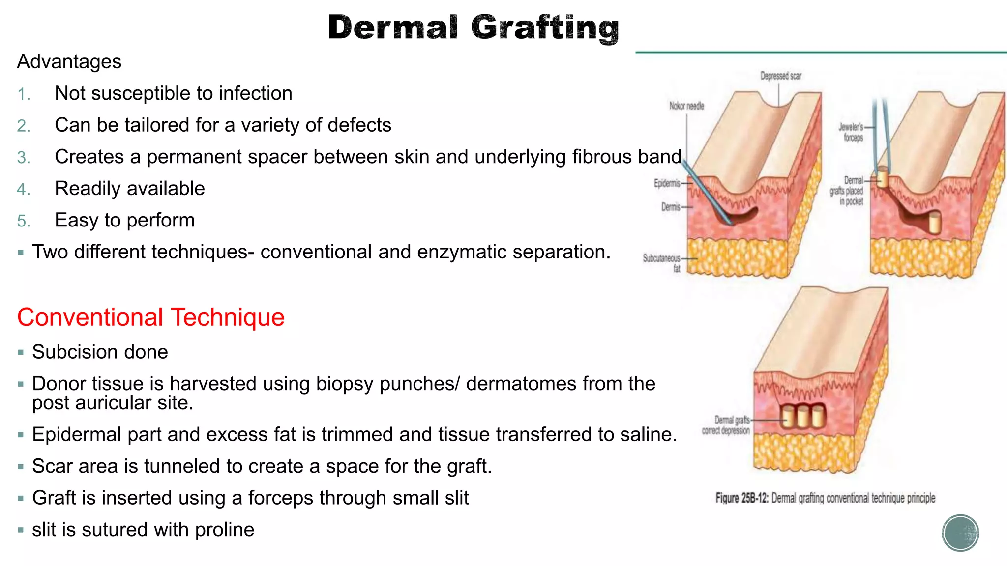 Acne scar management | PPTX
