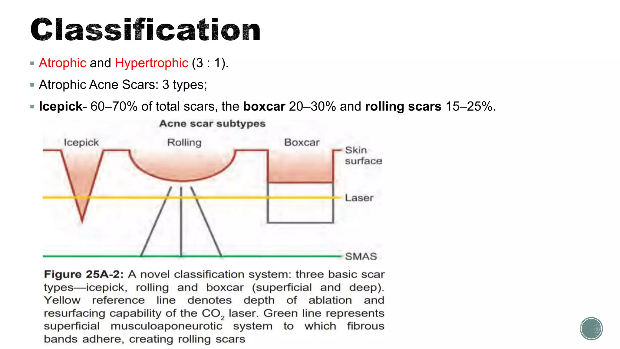 Acne scar management | PPTX