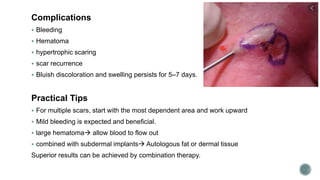 Acne scar management | PPTX