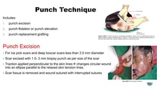 Acne scar management | PPTX