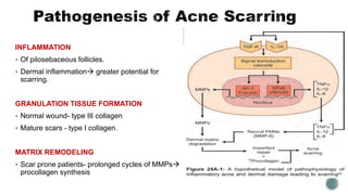 Acne scar management | PPTX