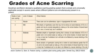 Acne scar management | PPTX