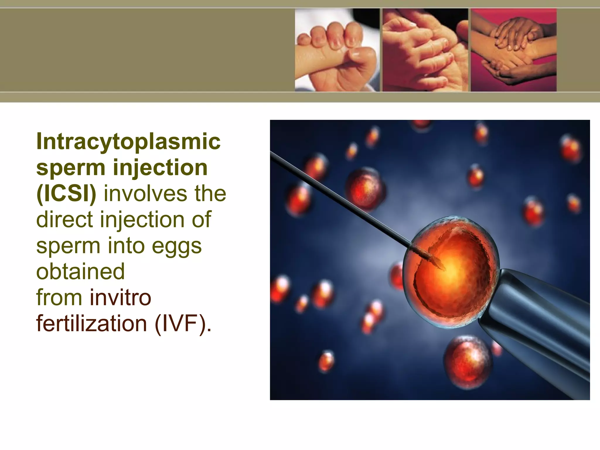 Assisted Reproductive Technologies | PPT