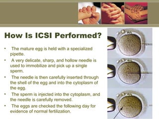 Assisted Reproductive Technologies | PPT