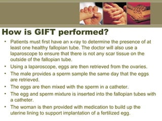 Assisted Reproductive Technologies | PPT