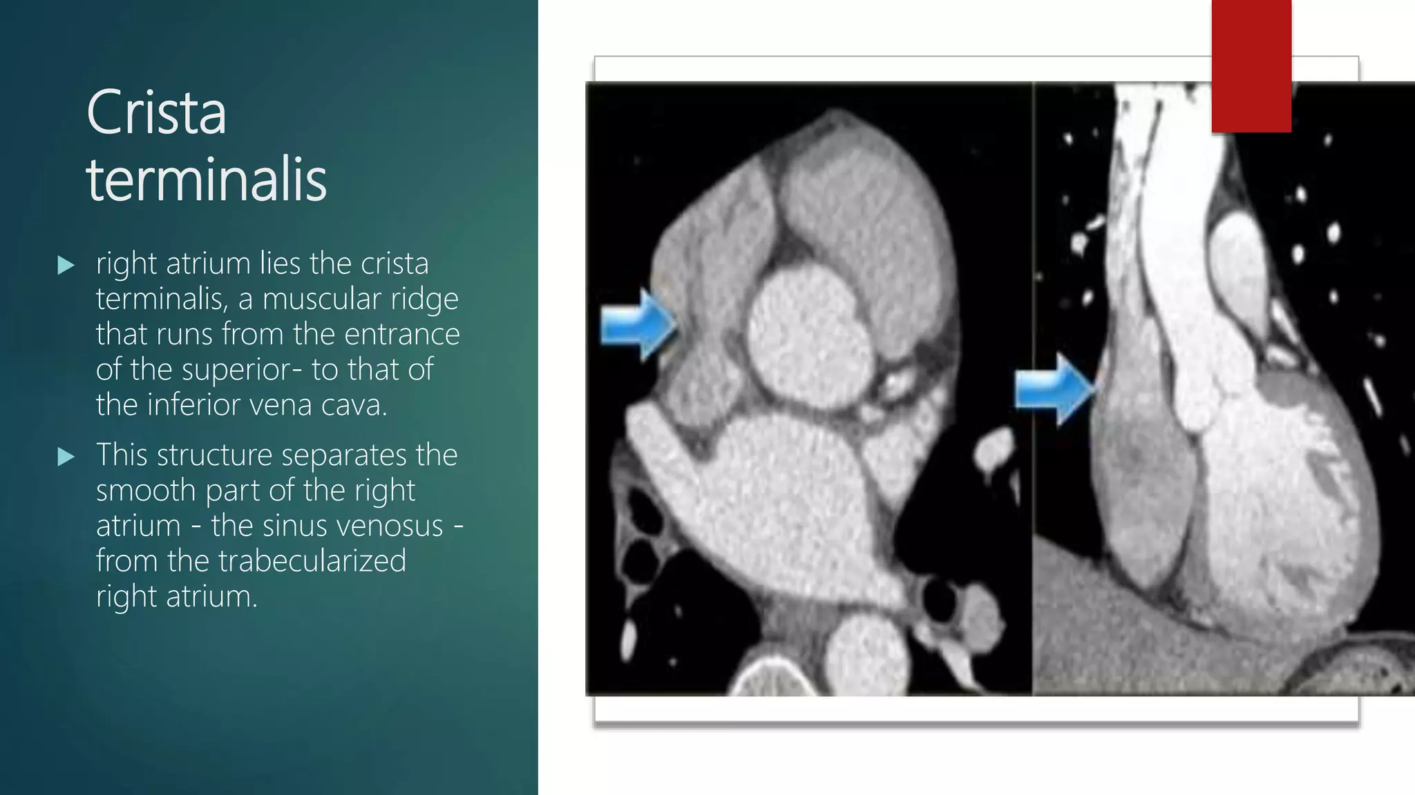 Valvular heart diseases imaging | PPTX