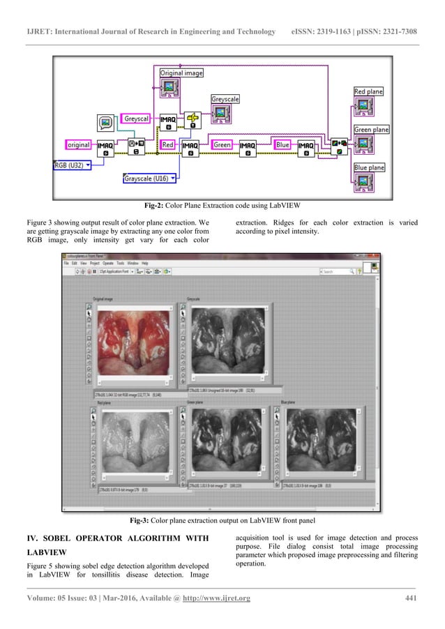 Vhdl Implementation For Edge Detection Using Log Gabor Filter For Disease Detection Pdf
