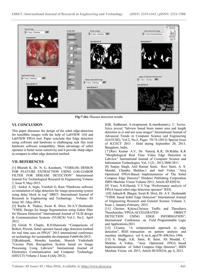 Vhdl implementation for edge detection using log gabor filter for disease detection | PDF ...