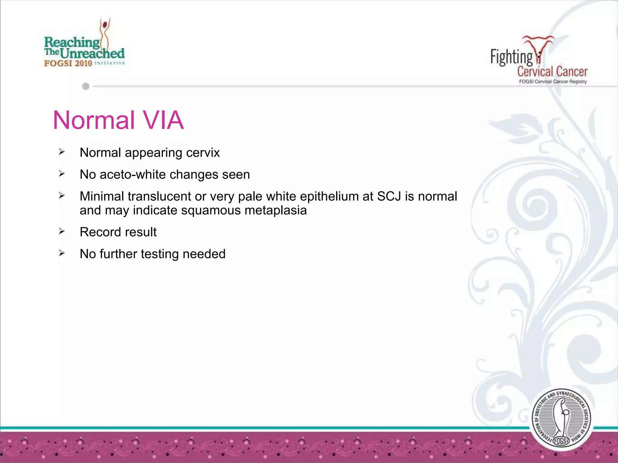 Via | PPT