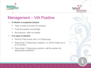 Via | PPT