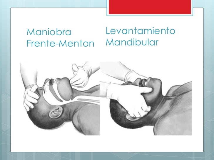 Manejo de la via aerea