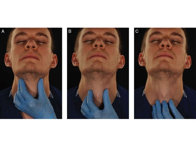 Difficult airway | PPT