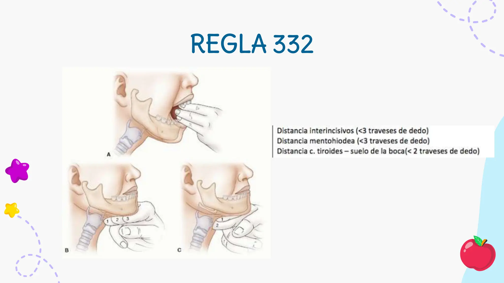 Via aerea dificil, diapositivas medicas avanzadas | PPTX