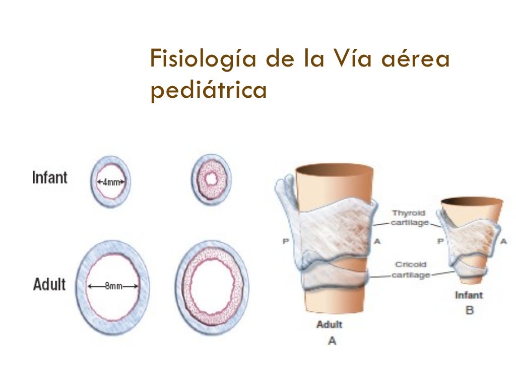 Via aerea pediatrica