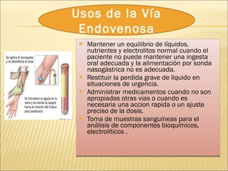 Via endovenosa | PPT