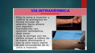 VIA INTRADERMICA.pptx | First Aid | Injuries