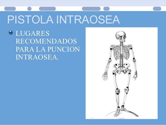 Via intraosea