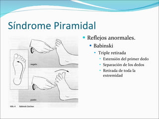Via piramidal | PPT