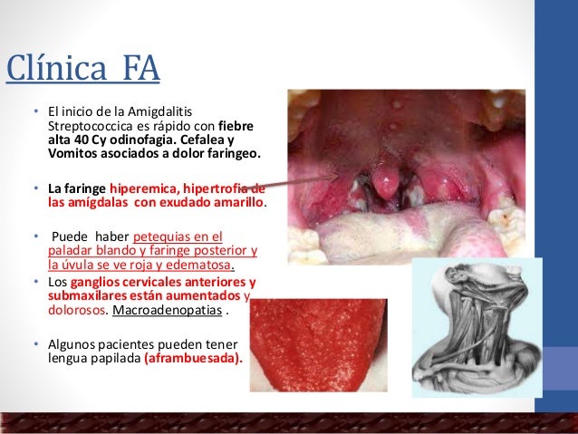 Vias aereas superiores 016