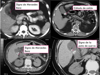 VIAS BILIARES ANATOMÍA Y CIRUGÍA GENERAL | PPTX