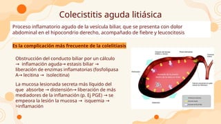 vias biliares/colecistitis aguda y crónica | PPTX