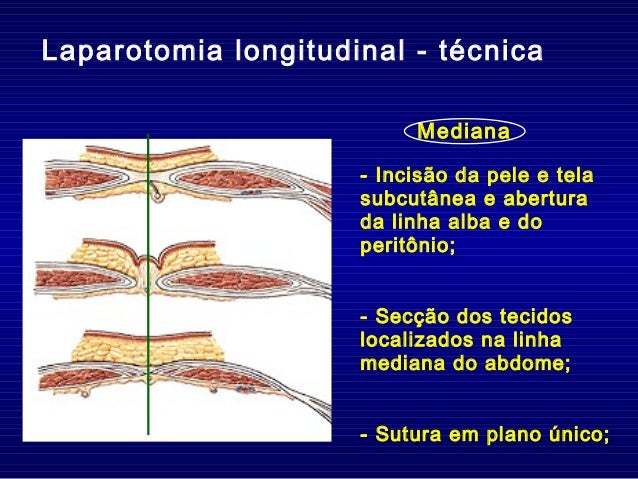 Aula - "Vias de Acesso à Cavidade Abdominal: laparotomia e videolapar…