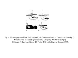 Vias enterales | PPT