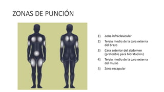 VIA SUBCUTANEA en el manejo adecuado del paciente paliativo.pptx