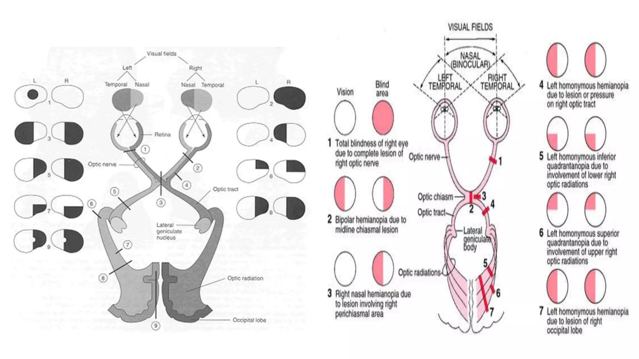 Via visual en oftalmologia | PPTX