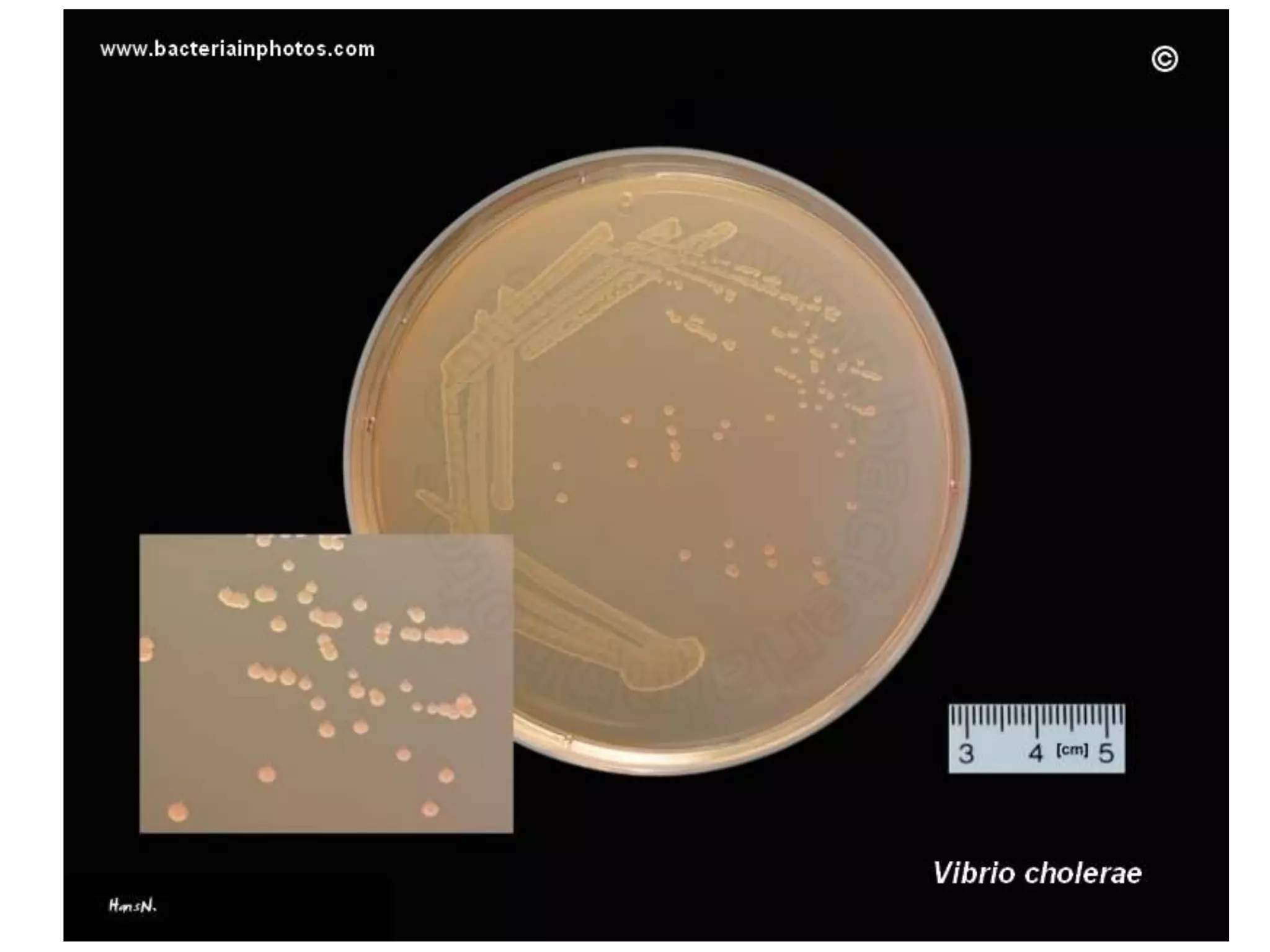 Vibrio the organism and laboratory diagnosis | PPTX