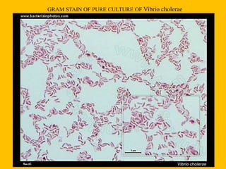 Vibrio Cholerae Gram Stain