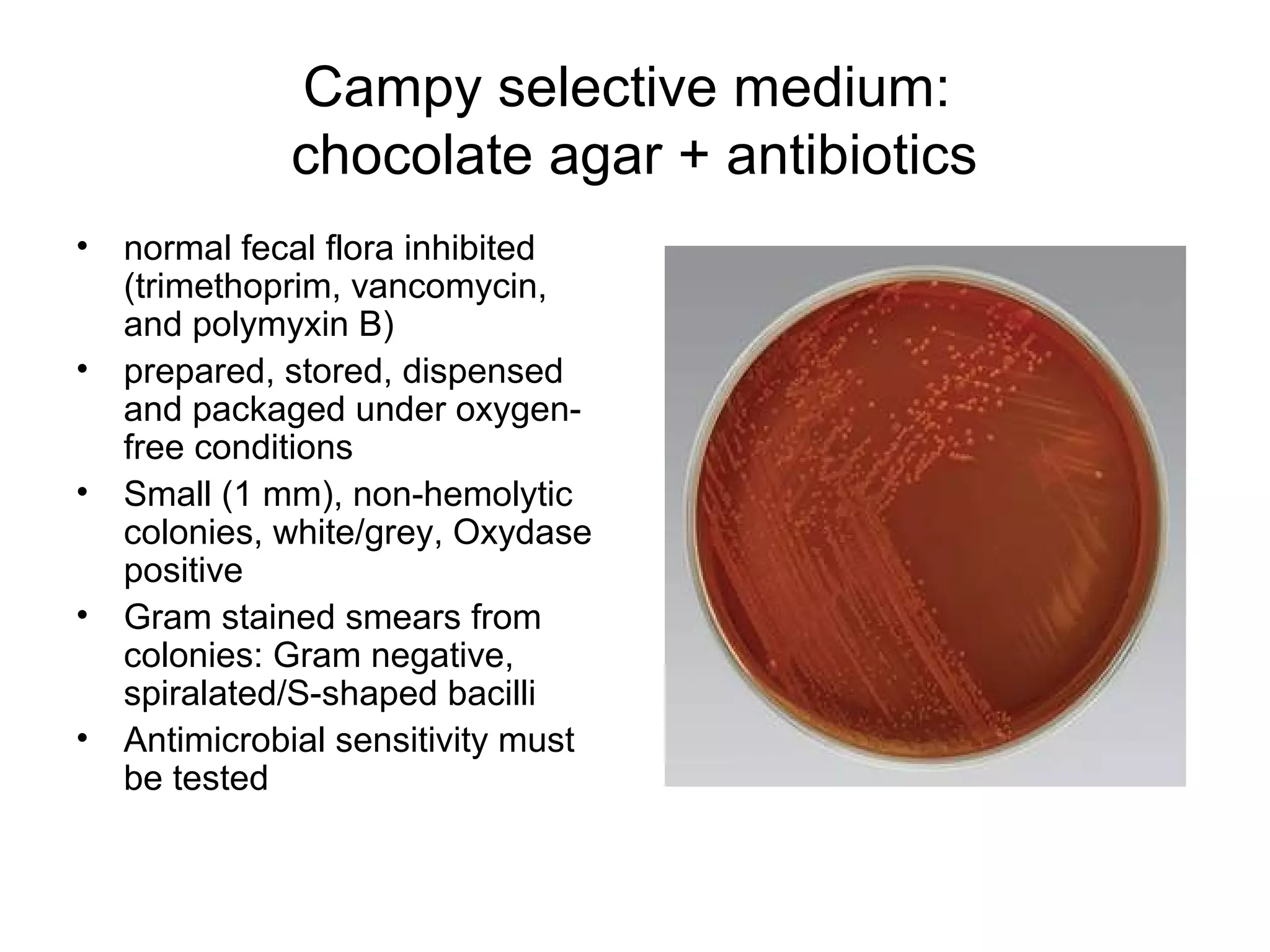 Vibrio campylobacter helicobacter_pseudomonas | PPT