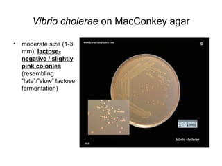 Vibrio campylobacter helicobacter_pseudomonas | PPT