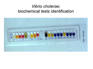 Vibrio campylobacter helicobacter_pseudomonas | PPT
