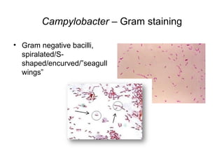 Vibrio campylobacter helicobacter_pseudomonas | PPT
