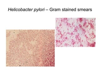 Vibrio campylobacter helicobacter_pseudomonas | PPT