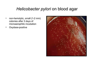 Vibrio campylobacter helicobacter_pseudomonas | PPT