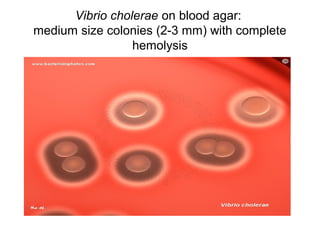 Vibrio campylobacter helicobacter_pseudomonas | PPT